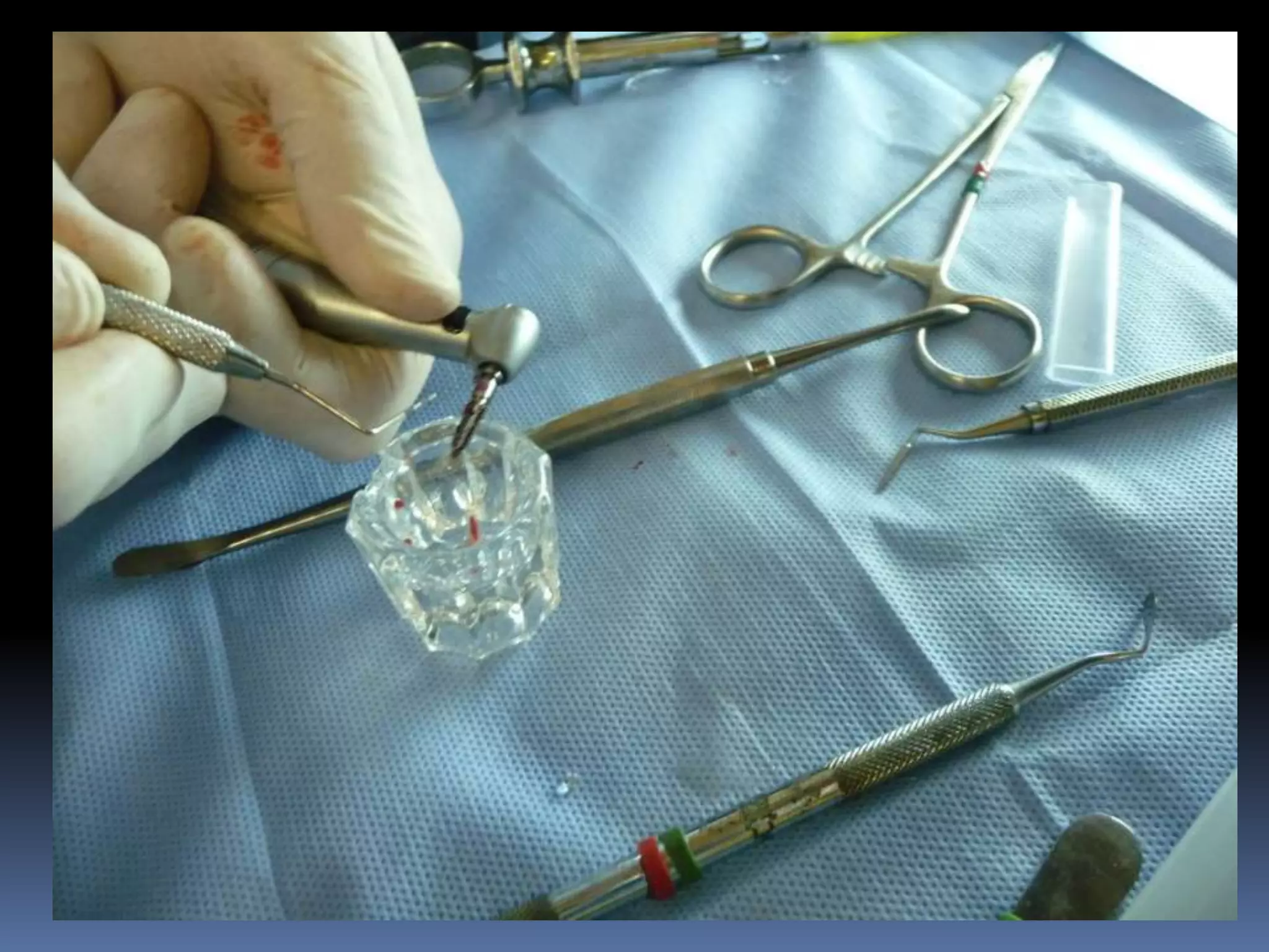 Mandibular Pre Molar Region Implant Placement Near Mental Nerve | PPT