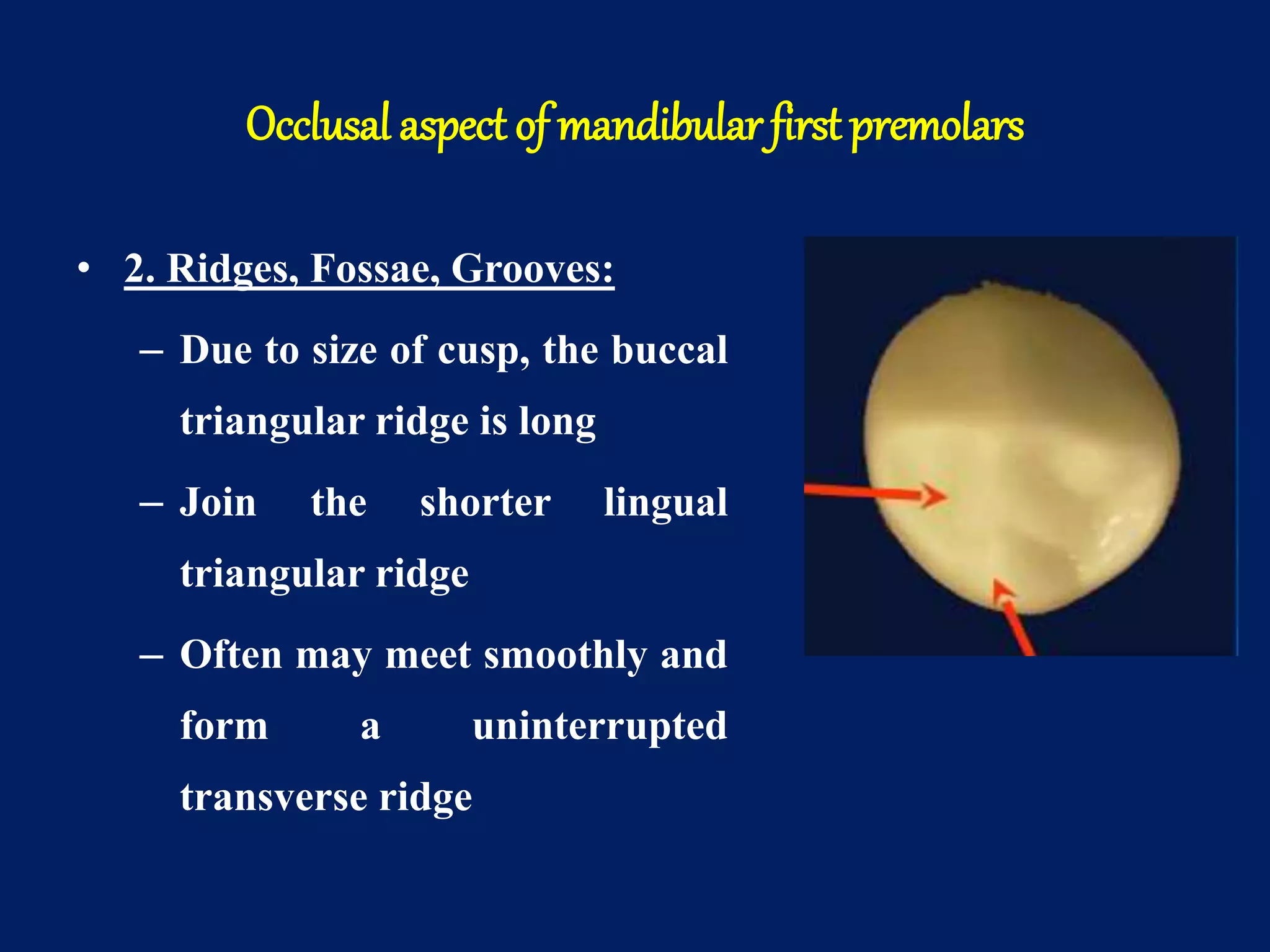 mandibular premolars.pptx