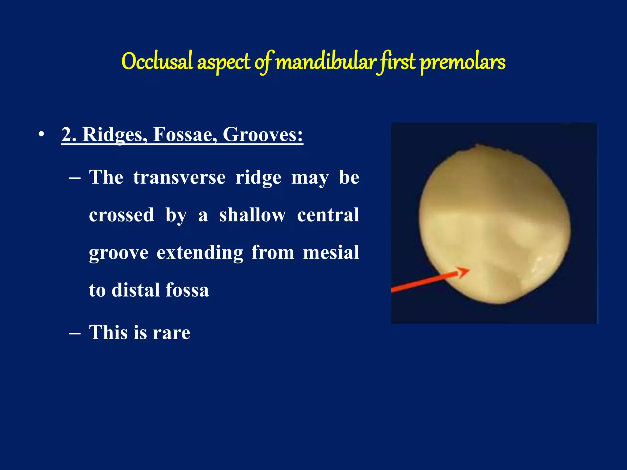 mandibular premolars.pptx