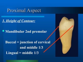 MAndibular prddddddddddddddddemolars.ppt