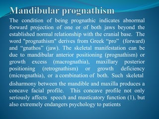 Mandibular prognathism | PPTX