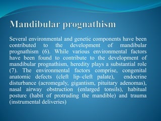 Mandibular prognathism | PPTX