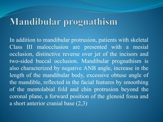 Mandibular Prognathism