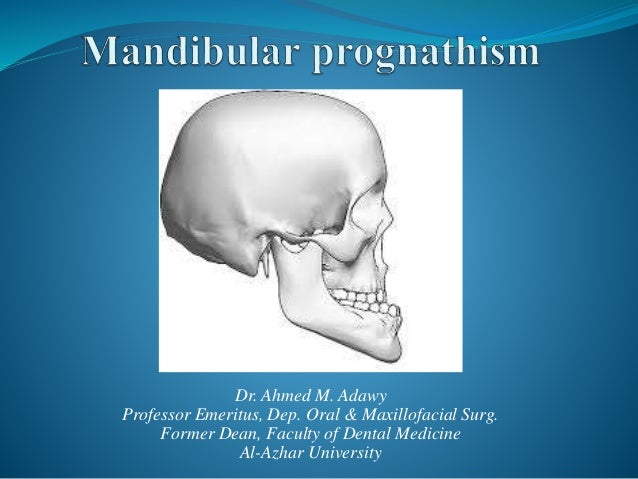 Mandibular prognathism