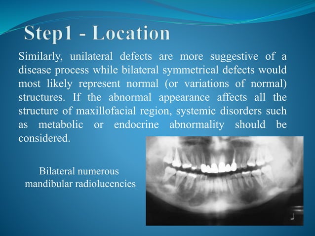 Mandibular Radiolucencies; A Systematic Approach to Diagnosis | PPTX ...