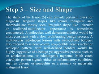 Mandibular Radiolucencies; A Systematic Approach to Diagnosis | PPTX