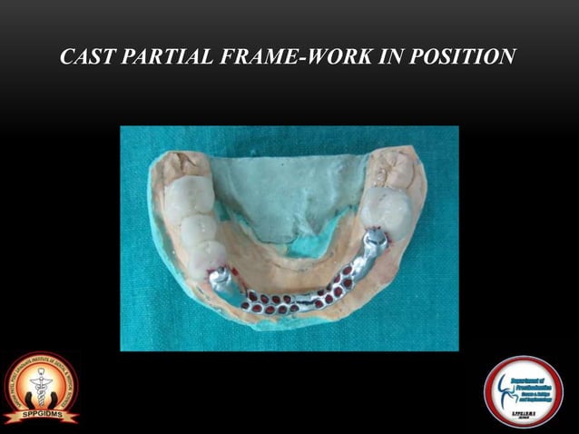 mandibular recnstruction.ppt