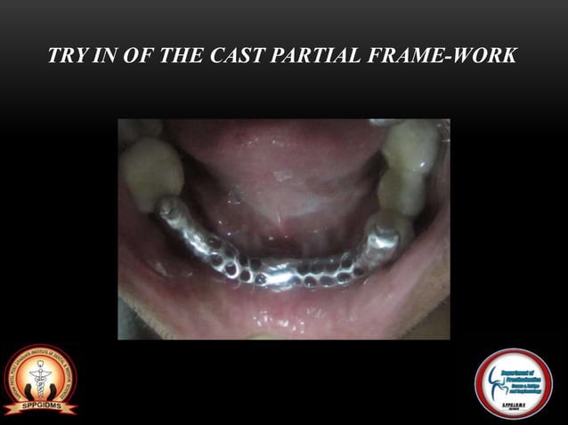 mandibular recnstruction.ppt