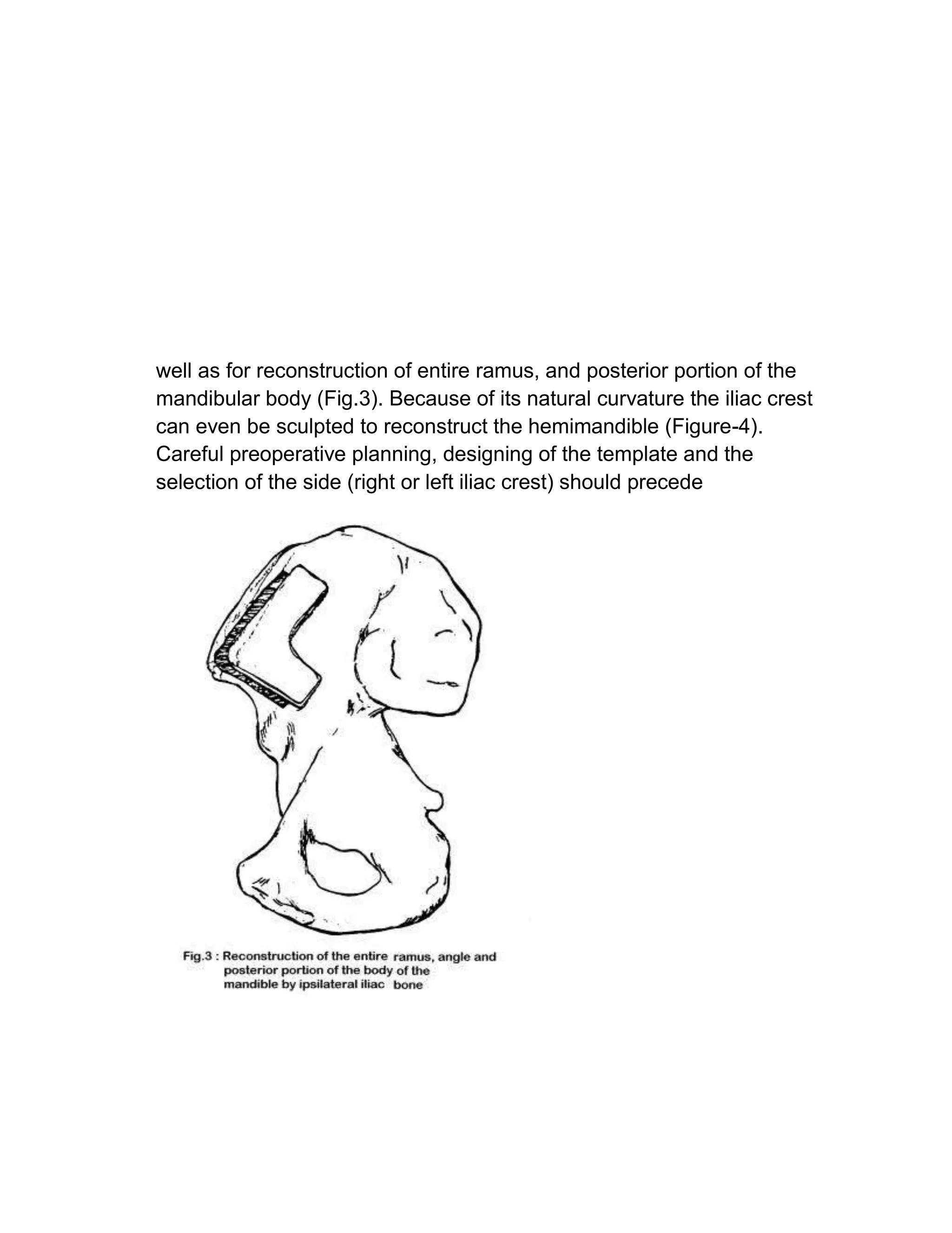 Mandibular reconstruction | DOCX