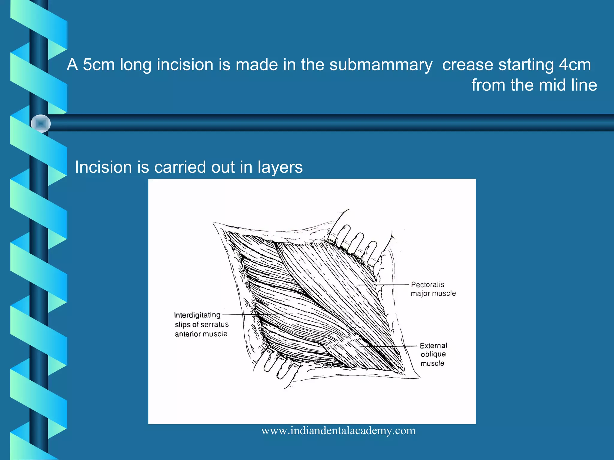 Mandibular reconstruction / oral surgery courses | PPT