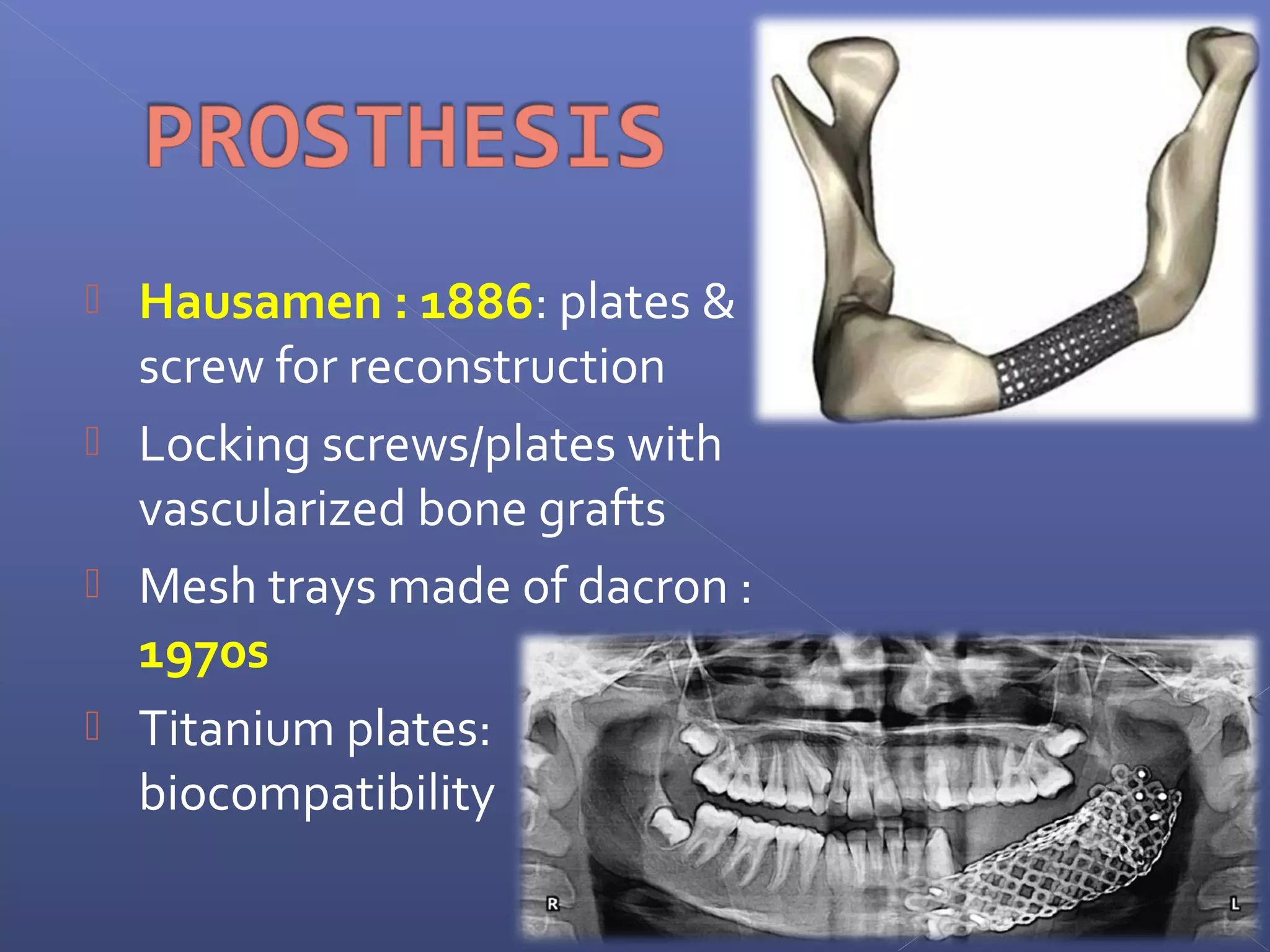 Mandibular reconstruction | PPT
