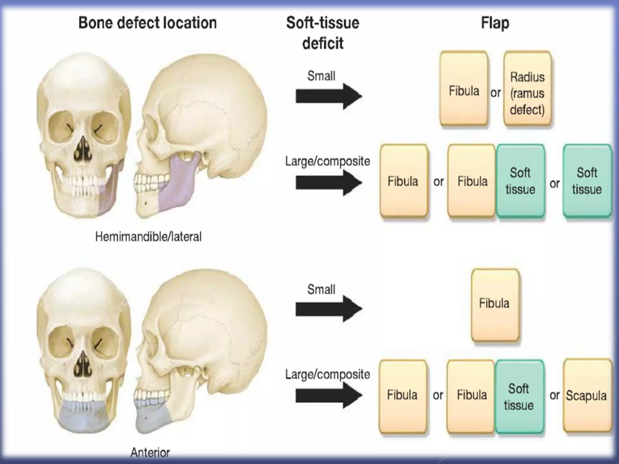 Mandibular reconstruction | PPT