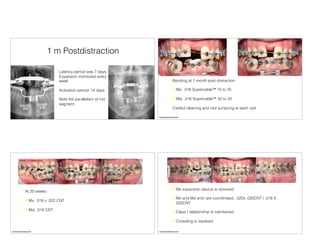 Mandibular Symphyseal Distraction Osteogenesis and SARPE aao 2018 ...