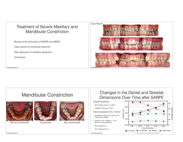 Mandibular Symphyseal Distraction Osteogenesis and SARPE aao 2018 ...
