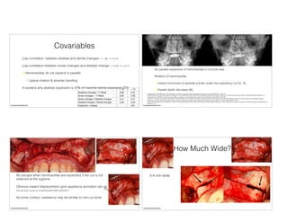 Mandibular Symphyseal Distraction Osteogenesis and SARPE aao 2018 ...
