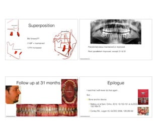 Mandibular Symphyseal Distraction Osteogenesis and SARPE aao 2018 ...