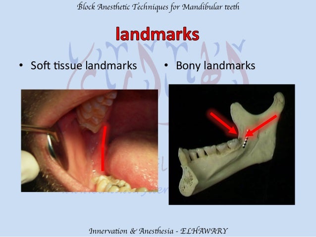 Mandibular teeth anesthetic block techniques