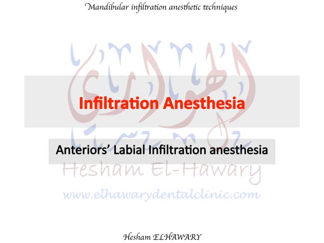 Mandibular teeth infilteration techniques | PDF