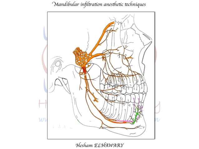 Mandibular teeth infilteration techniques | PDF