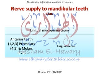 Mandibular teeth infilteration techniques | PPT