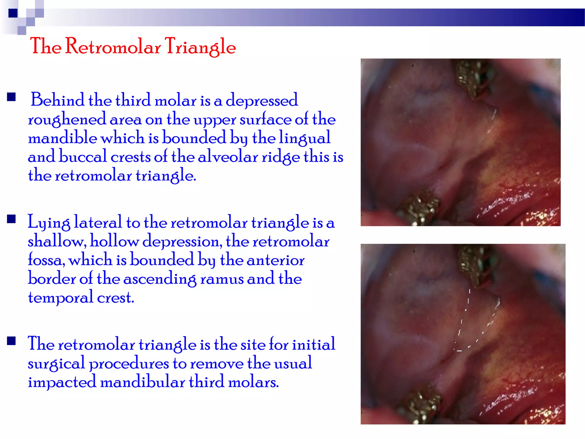 Mandibular third moalr impaction | PPT