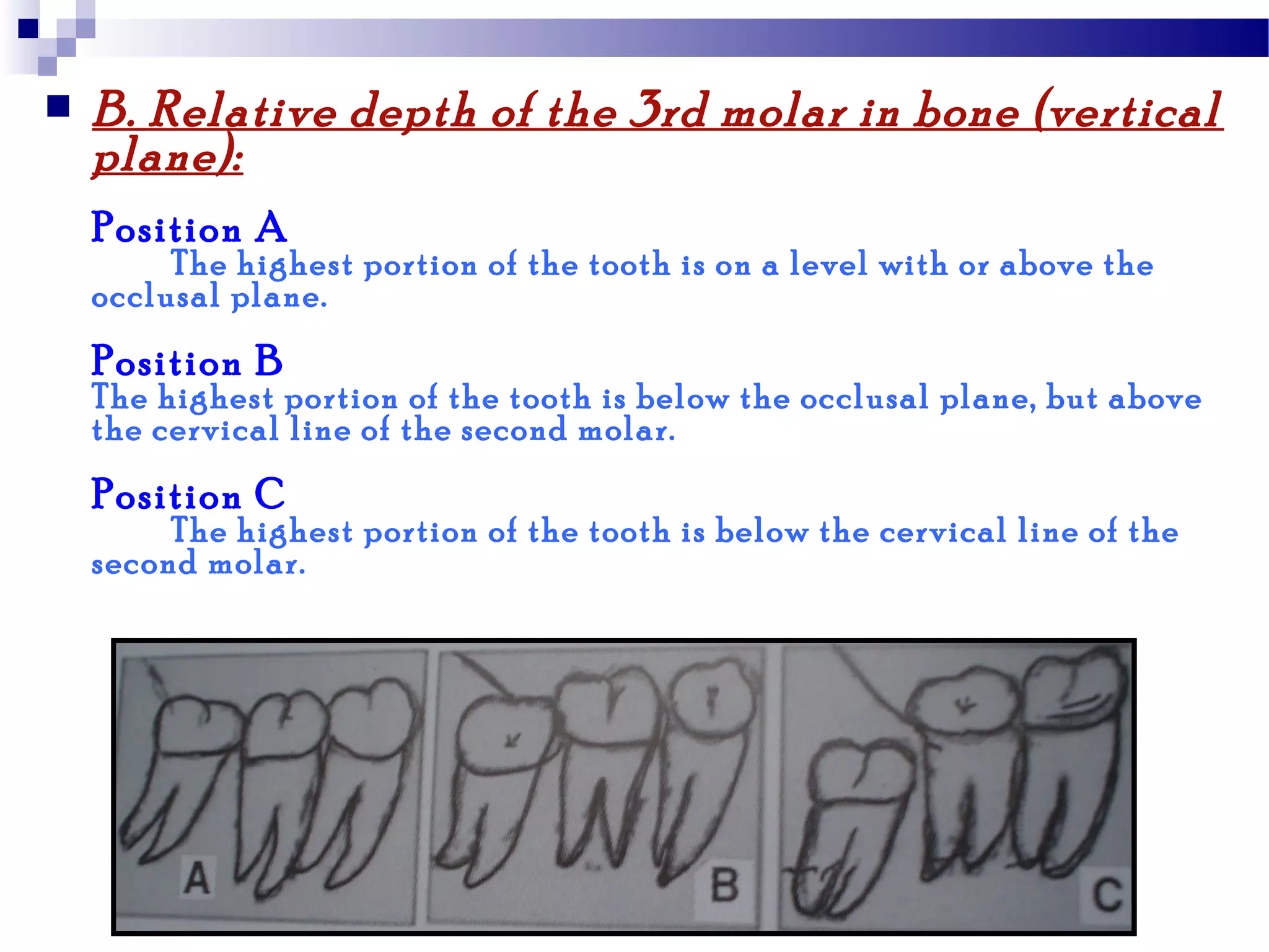 Mandibular third moalr impaction | PPT