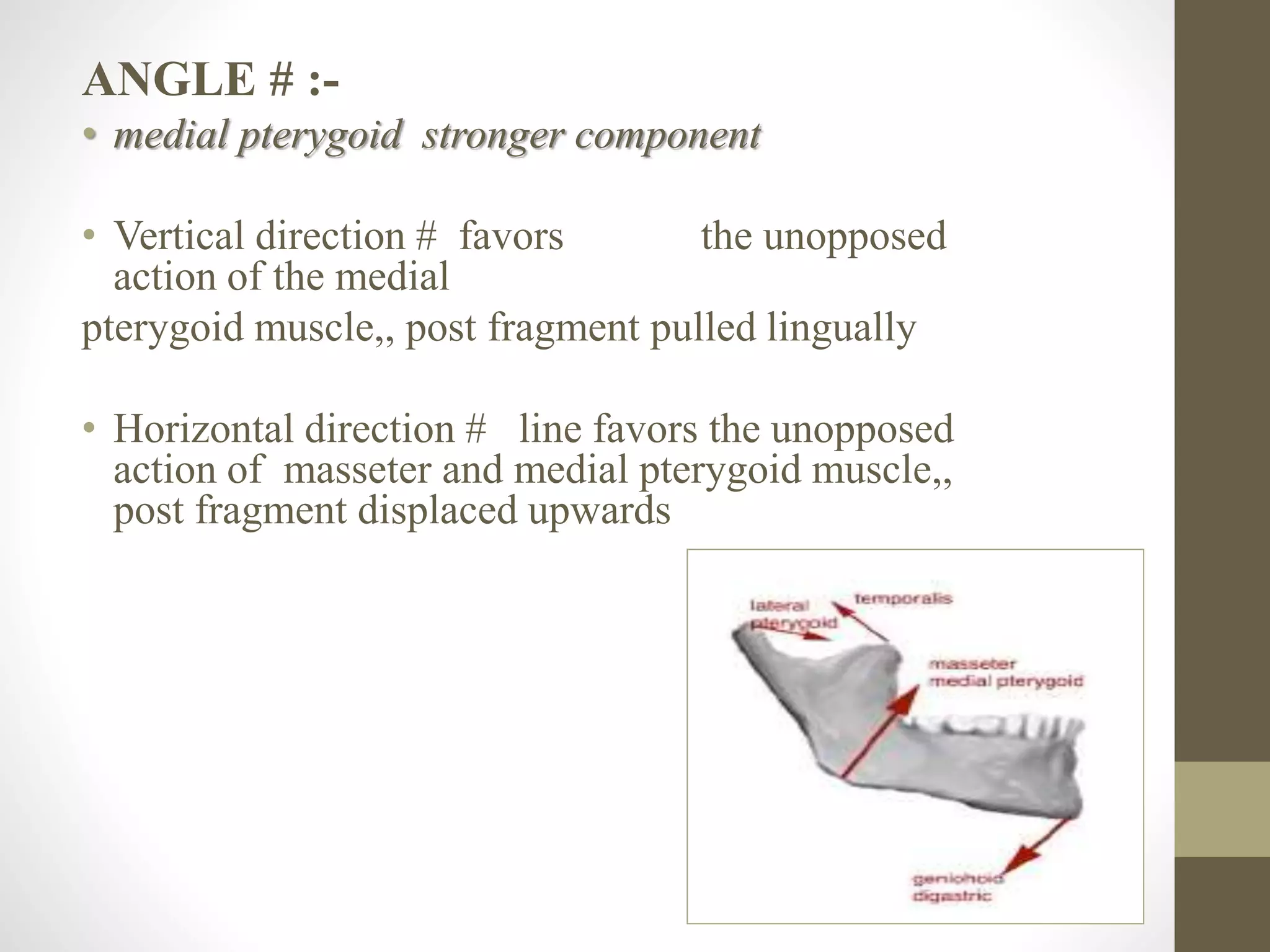 Mandibular trauma | PPTX