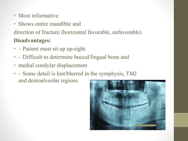 Mandibular trauma | PPTX | Dental Health | Diseases and Conditions