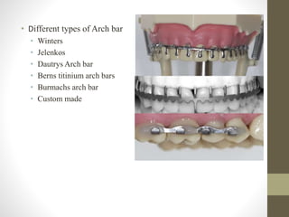 Mandibular trauma | PPTX