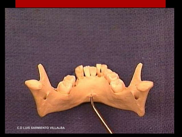 HUESO MAXILAR INFERIOR | PPTX