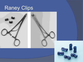 Avoid Falling Objects: Management of Severe Scalp Lacerations | PPTX