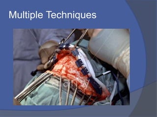 Avoid Falling Objects: Management of Severe Scalp Lacerations | PPTX