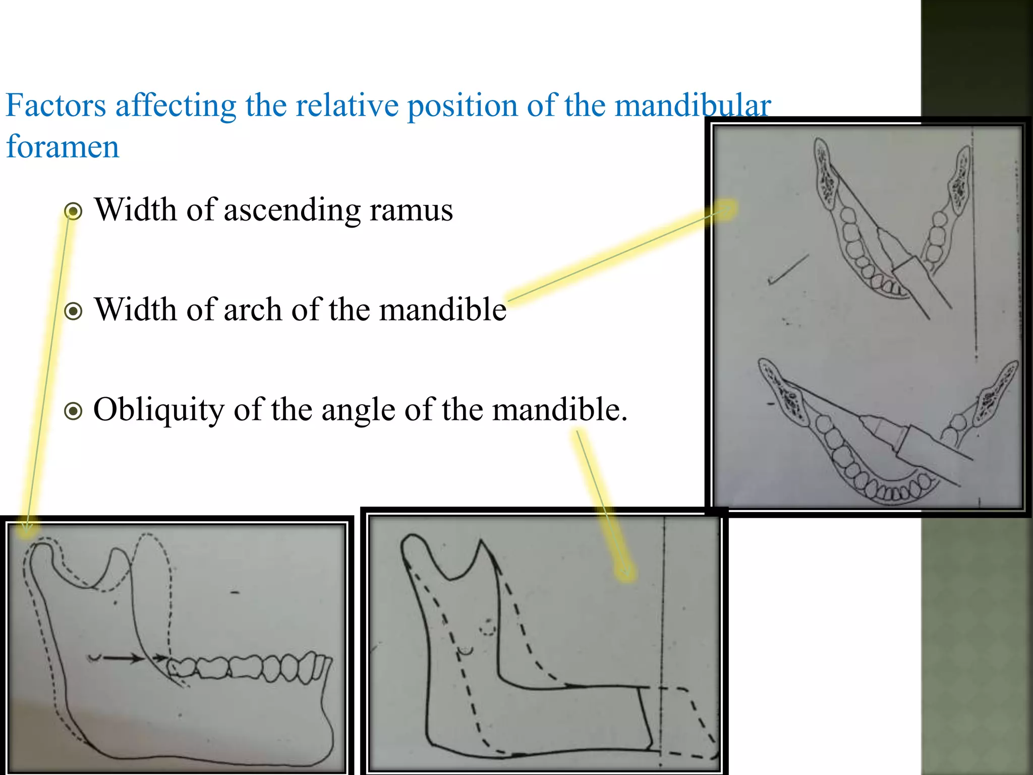 Mandibular nerve blocks techniques | PPTX