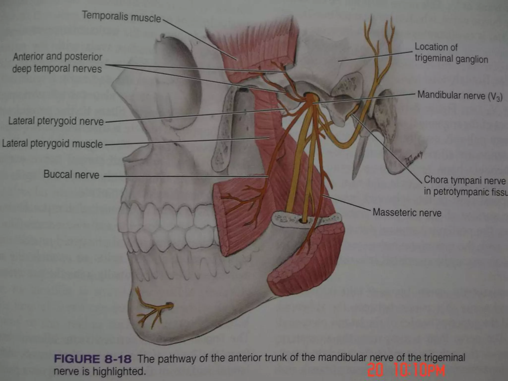 Mandibular nerve blocks techniques | PPTX