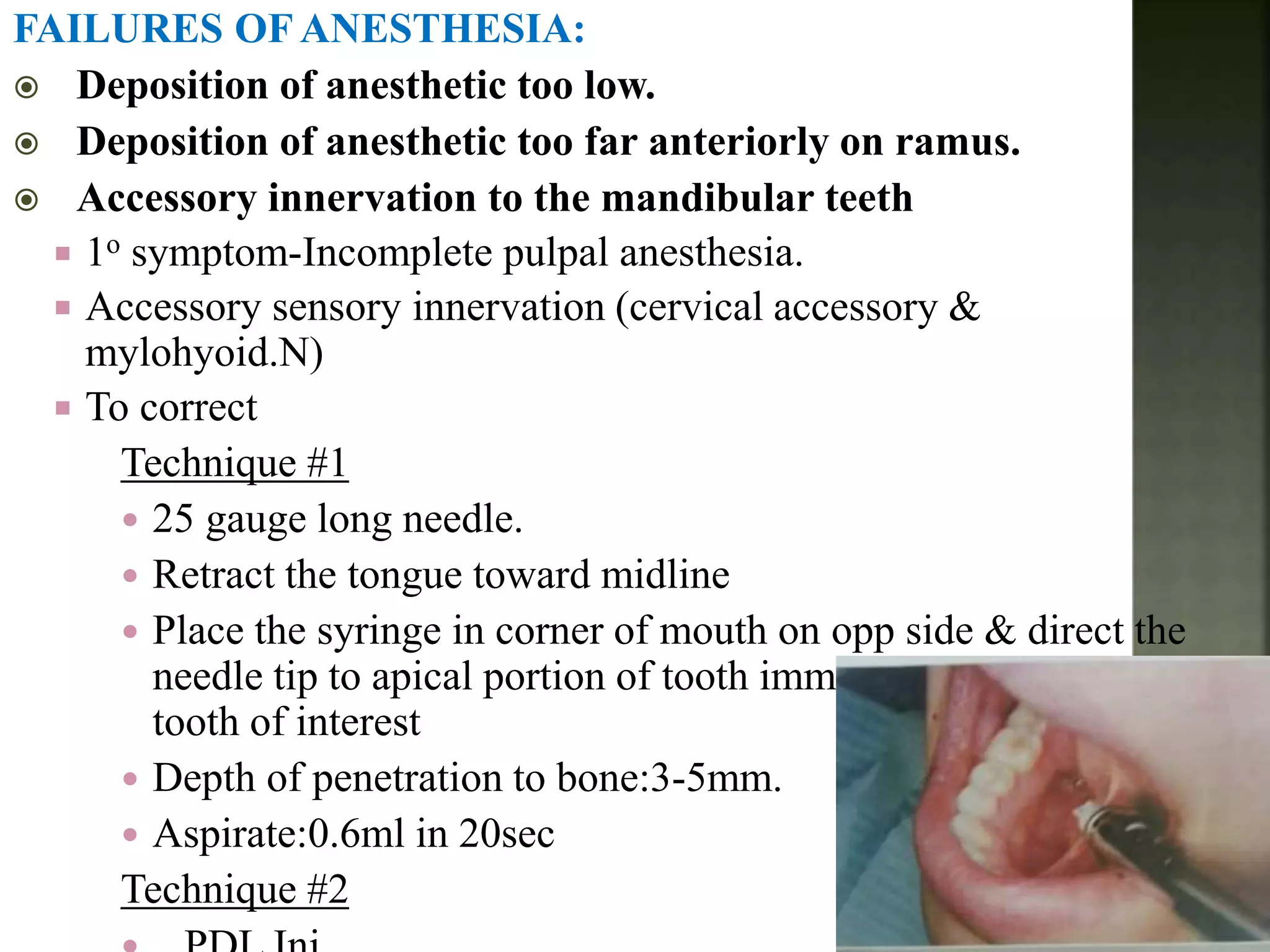 Mandibular nerve blocks techniques | PPTX