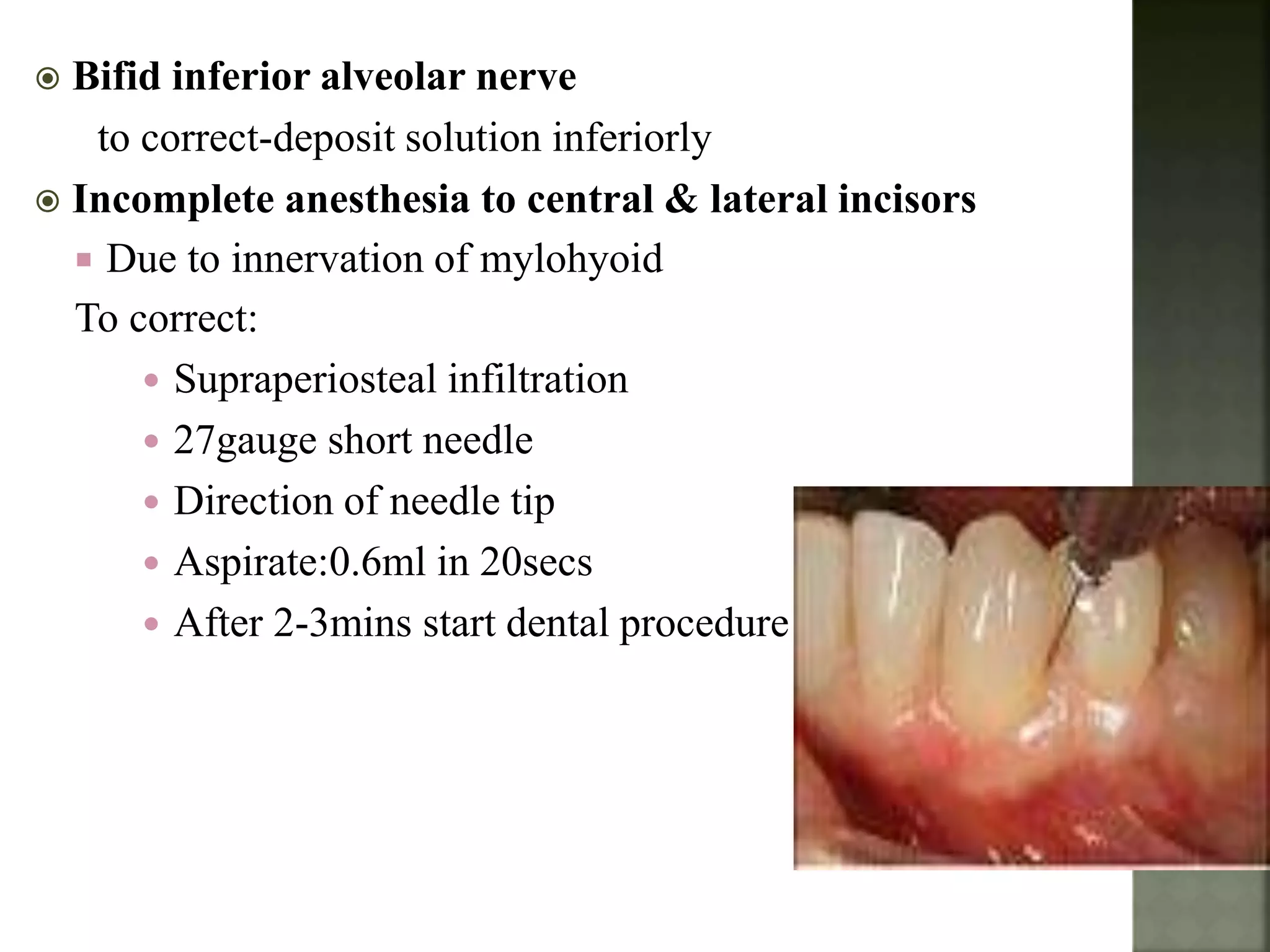 Mandibular nerve blocks techniques | PPTX