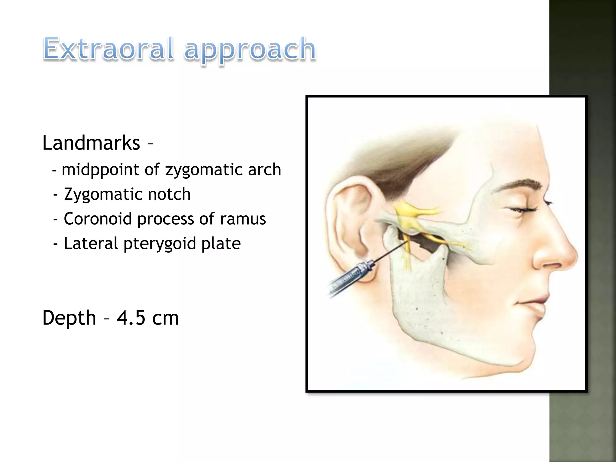 Mandibular nerve blocks techniques | PPTX