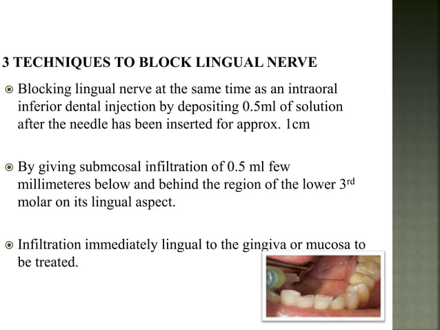 Mandibular nerve blocks techniques | PPTX | Ear, Nose and Throat ...
