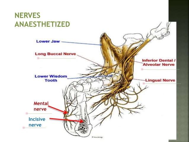 Mandibular nerve blocks techniques | PPTX | Ear, Nose and Throat ...