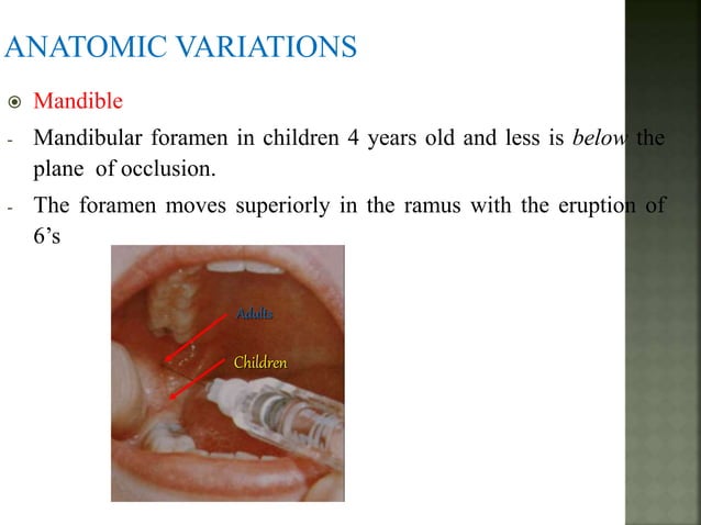 Mandibular nerve blocks techniques | PPTX | Ear, Nose and Throat ...