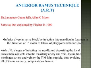 Mandibular nerve blocks techniques | PPTX