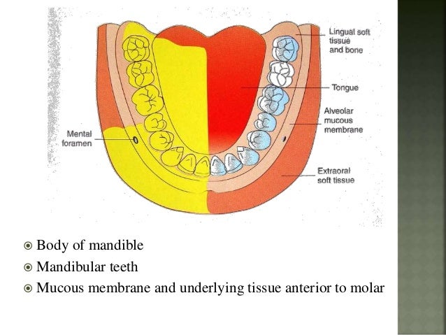 Mandibular nerve blocks techniques