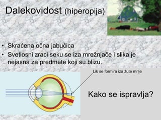 Mane i oboljenja oka | PPTX