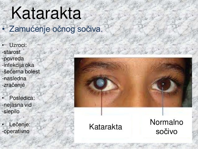 Mane i oboljenja oka