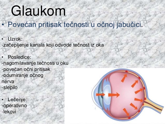 Mane i oboljenja oka