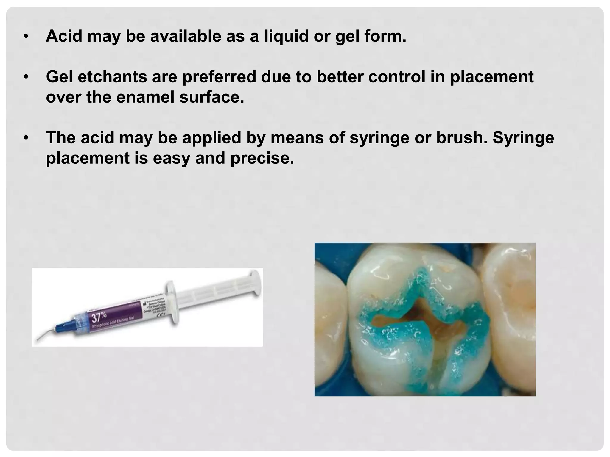 bonding to enamel & dentin | PPTX
