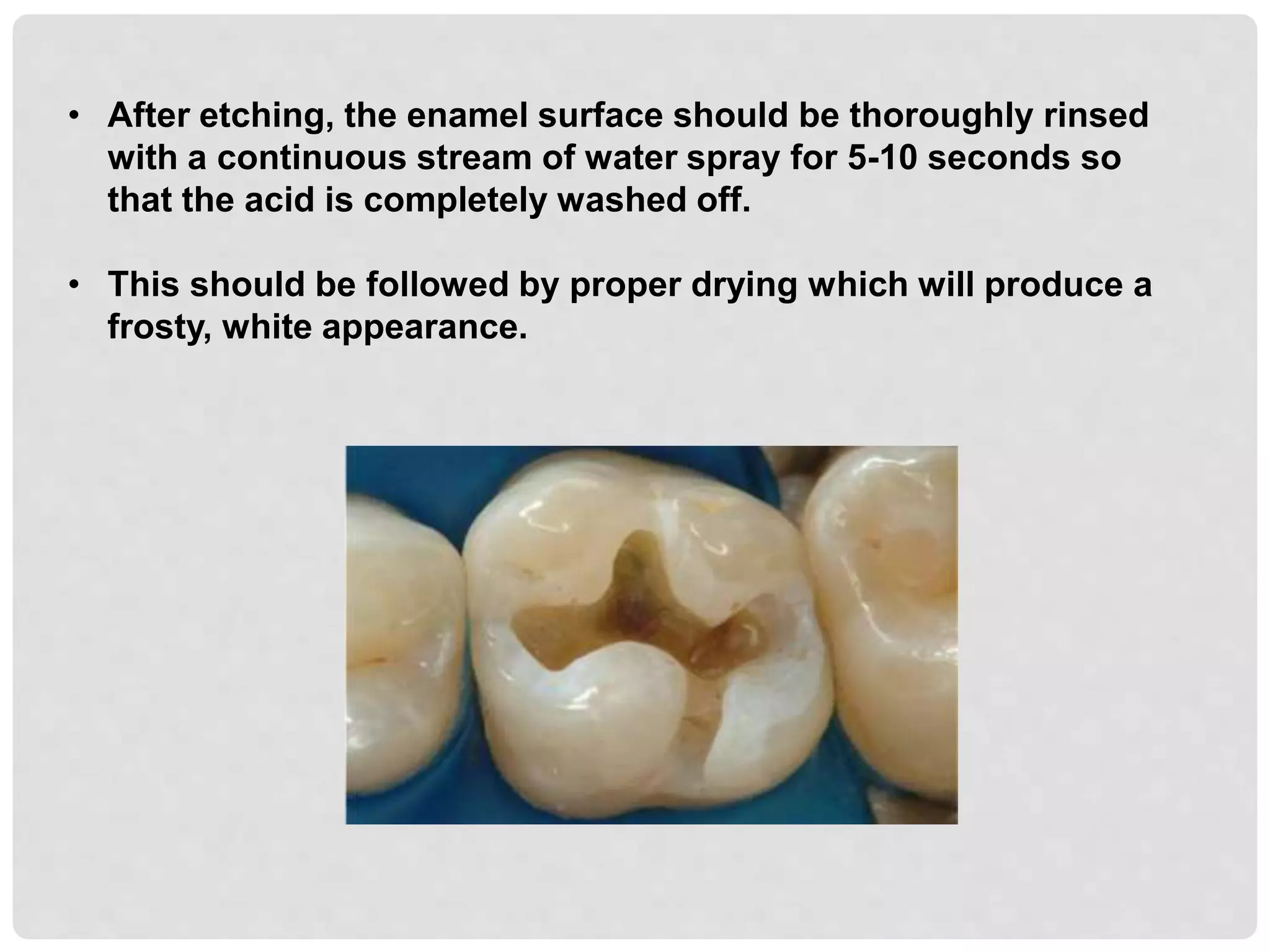 bonding to enamel & dentin | PPTX