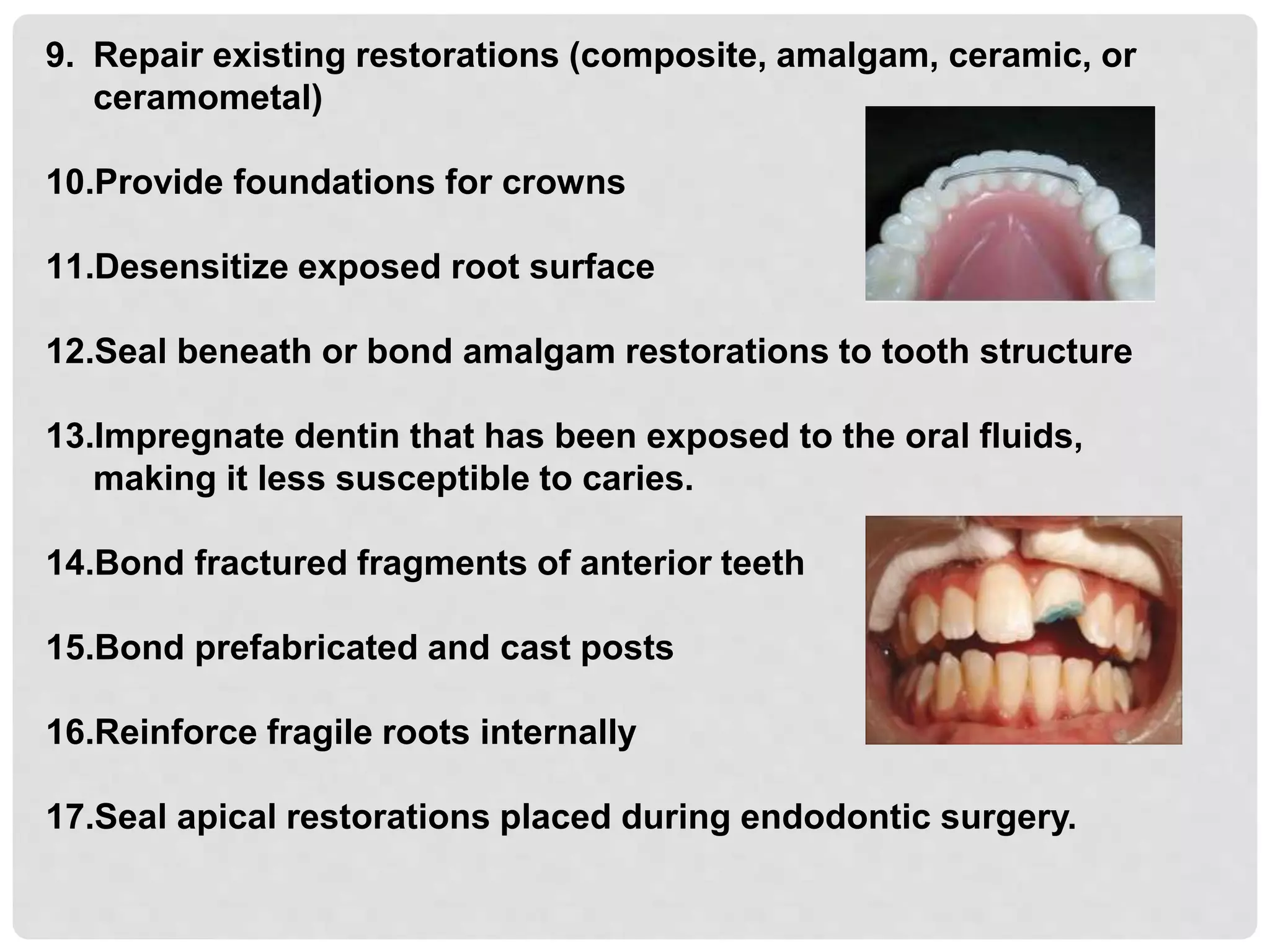 bonding to enamel & dentin | PPTX