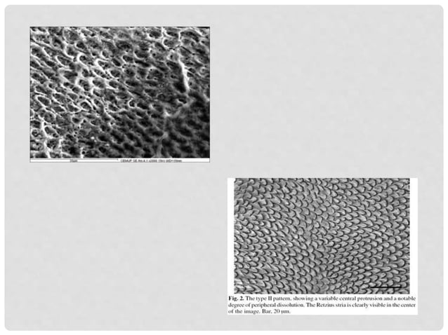 bonding to enamel & dentin | PPTX
