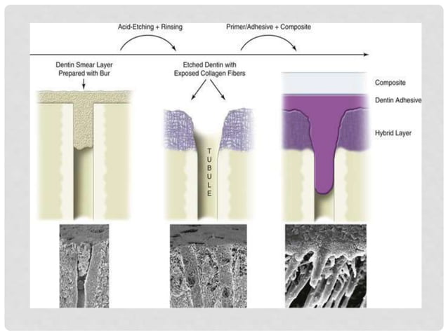 bonding to enamel & dentin | PPTX